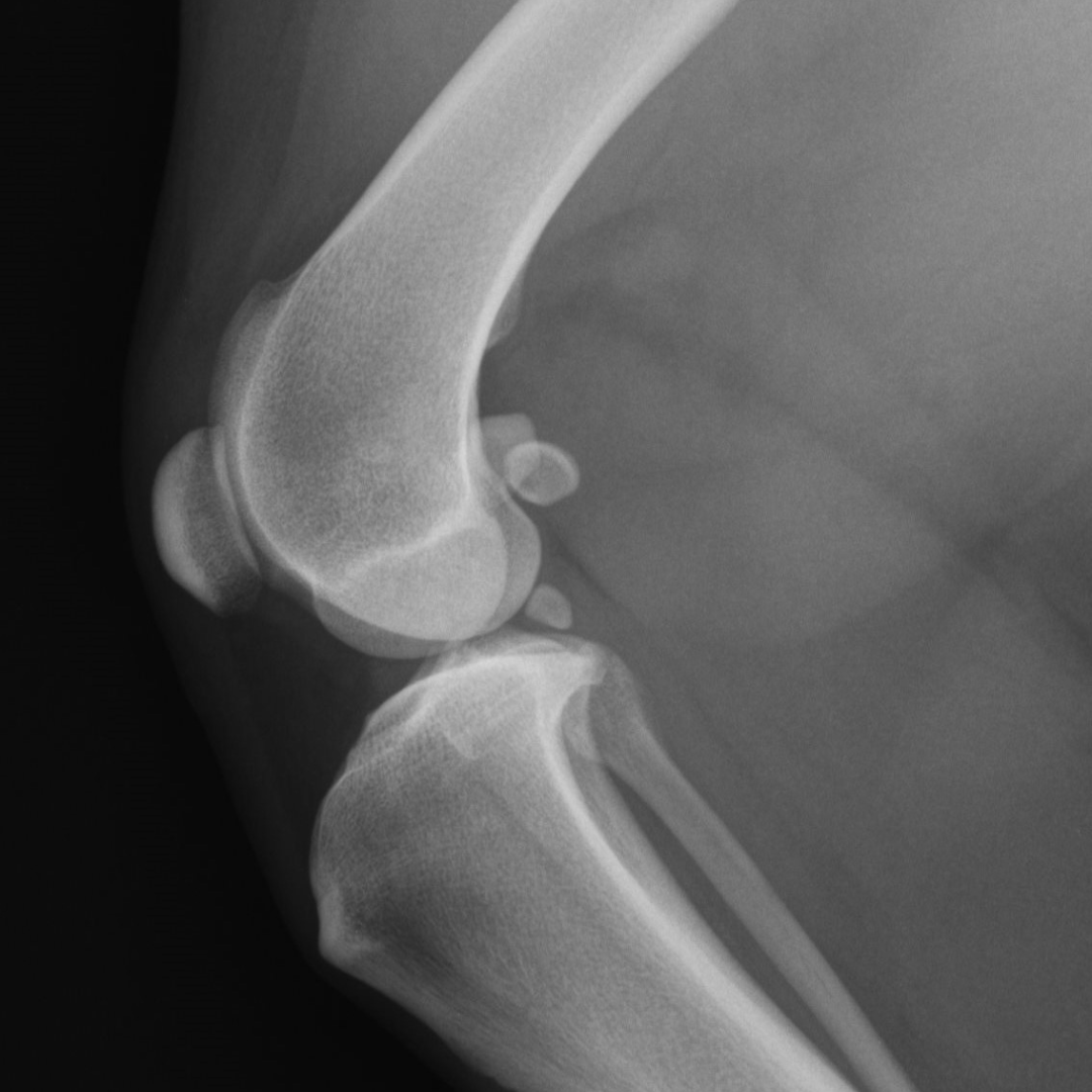 Cranial Cruciate Ligament Diseases – Animalius